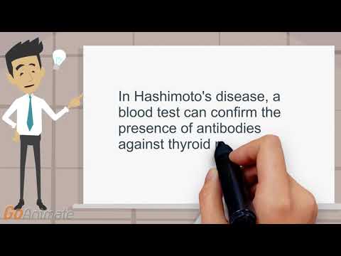 TPO antibodies in hypothyroidism