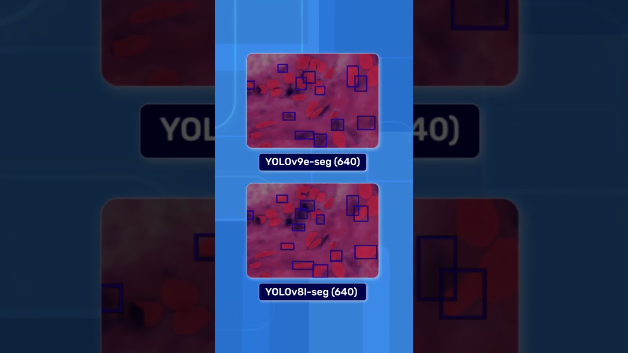 Instance Segmentation for Medical Imaging: YOLOv8 vs YOLOv9