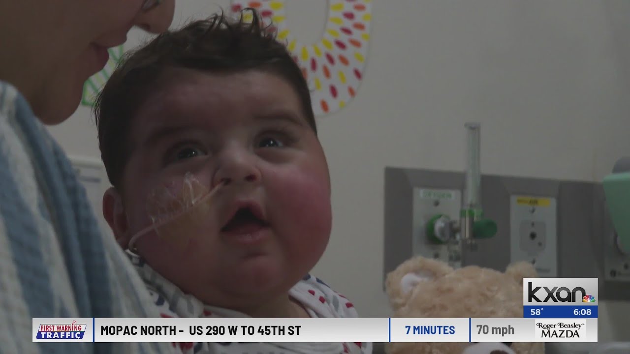 Baby receives successful heart transplant at Dell Children's hospital | KXAN News Today