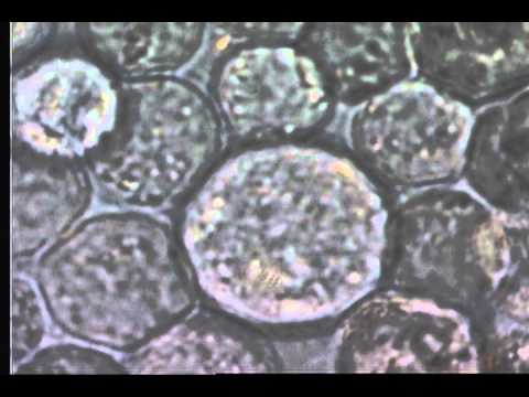 Gold nanorods move along the edge of the membrane of a HeLa cell.