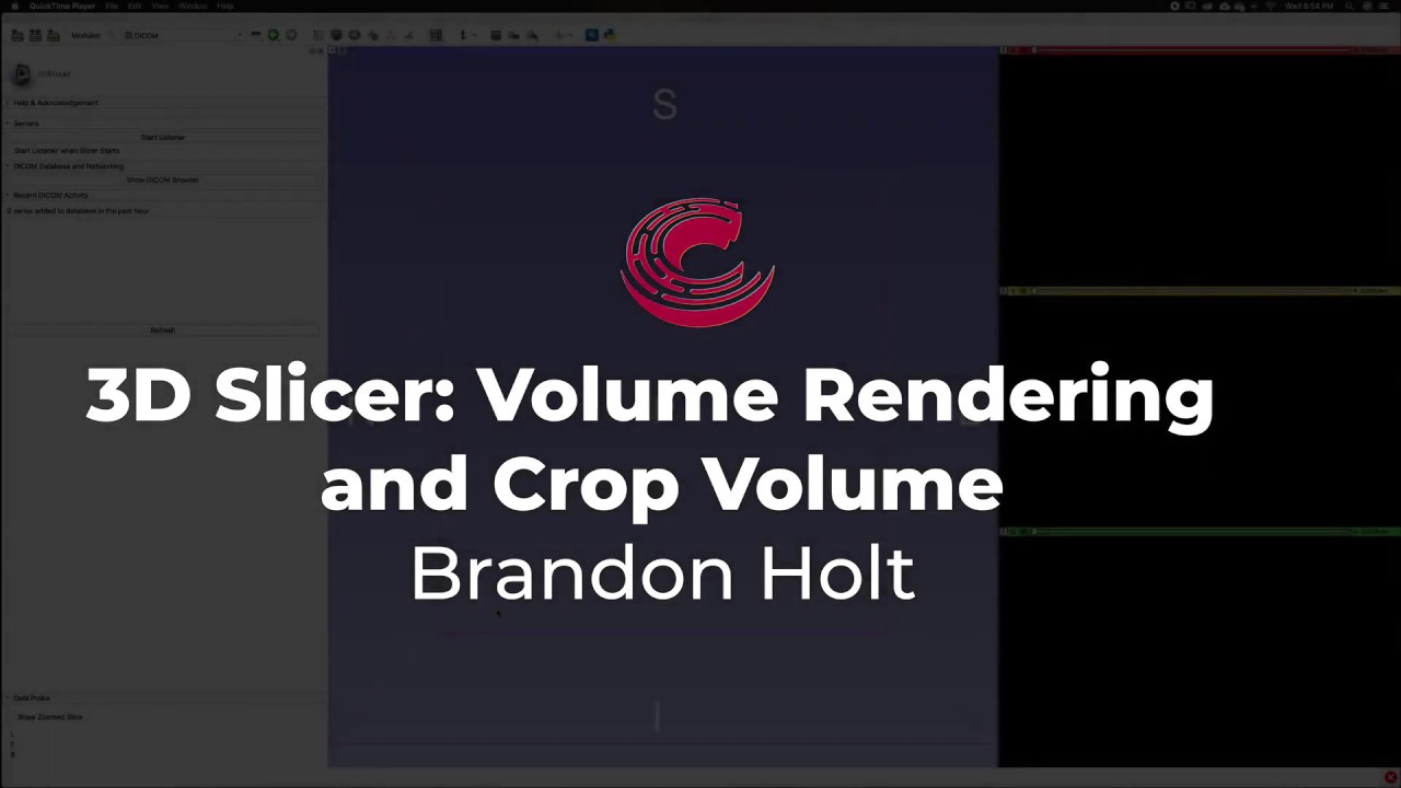 3D Slicer - Volume Rendering and Crop Volume