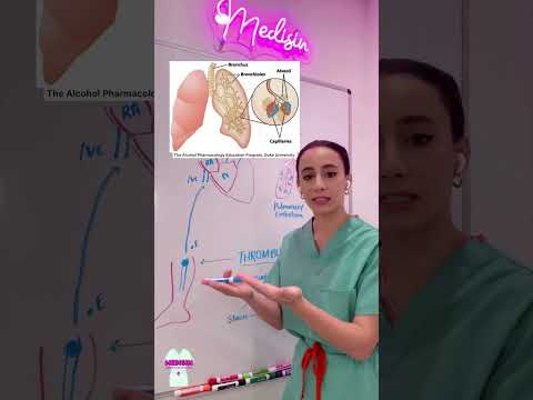 Deep Vein Thrombosis and Pulmonary Embolism - Pathophysiology, Signs, Symptoms