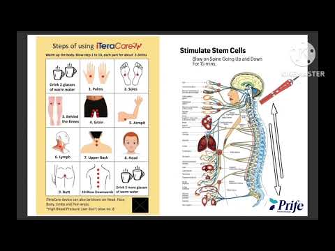 Guide on how to use Iteracare points -> RedMagicWand.com | iTeracare ...