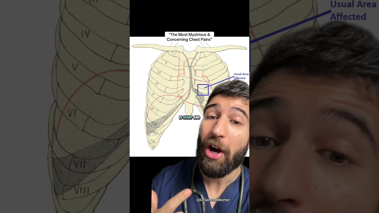 Doctor Explains Concerning Chest Pains