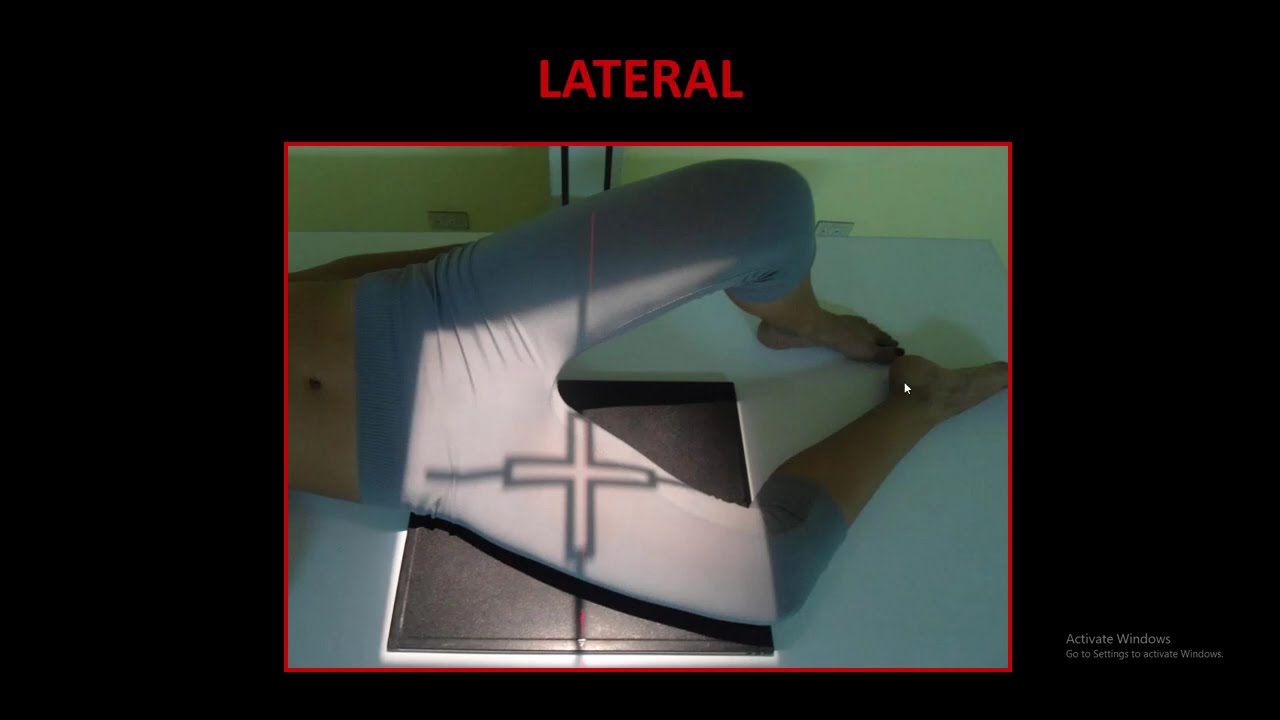 (RAYOS X - CLASE 17) RADIOGRAFIAS DE LAS EXTREMIDADES INFERIORES (ANATOMIA Y REALIZACION)