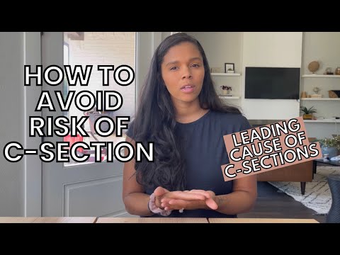 Failing to progress in labor | How to avoid a c-section | Tips for the Stages of Labor