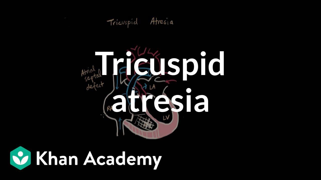 Tricuspid atresia | Circulatory System and Disease | NCLEX-RN | Khan Academy