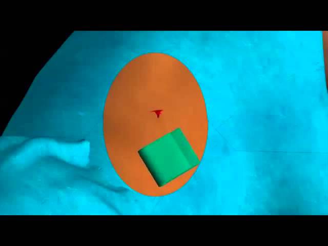 IPC Chest Drainage Kit - Indwelling Pleural Catheter Trader - Retailer ...