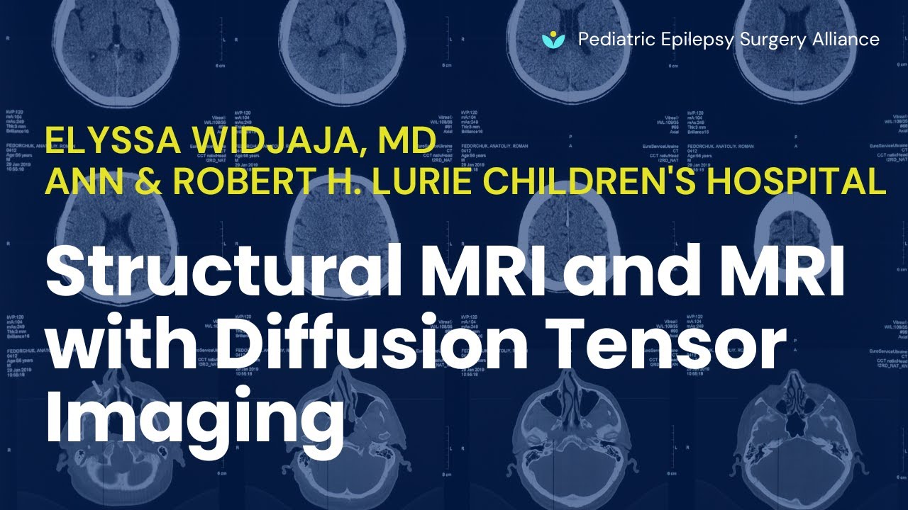 All About Structural MRI and MRI with Diffusion Tensor Imaging