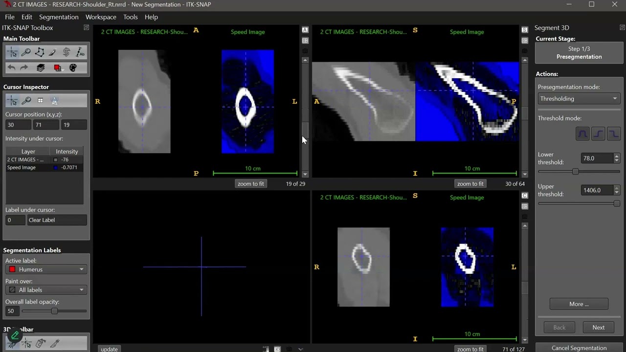 ITK-SNAP Basics Tutorial