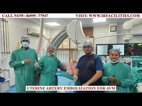 Uterine Artery Embolization for AVM | IRFACILITIES