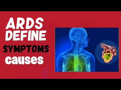 Acute respiratory distress syndrome (ARDS) #define, symptoms,causes