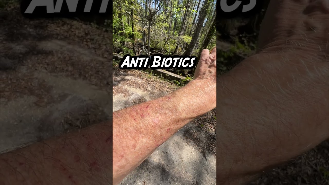 Snake Bite 24 Hour Update
