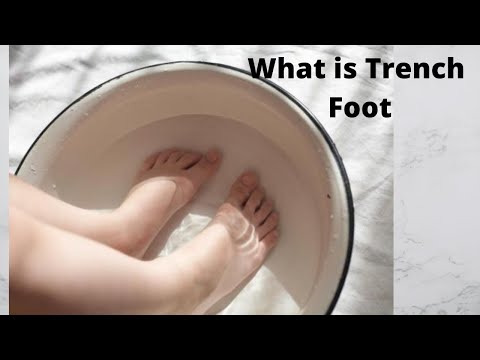 What is Trench Foot