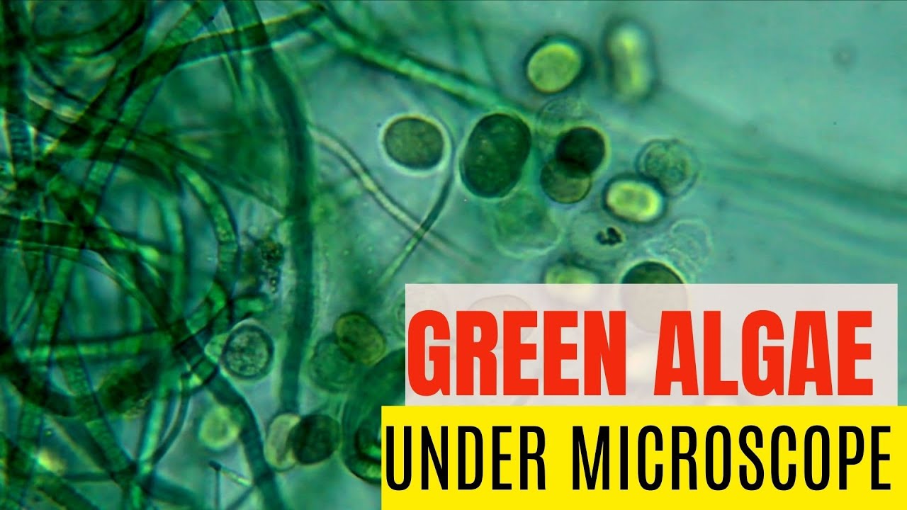 Green Algae Under Microscope
