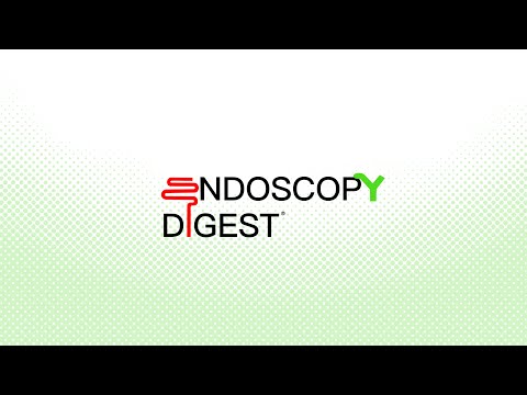 Endoscopic Direct Transgastric ERCP (EDGE, EUS guided jejuno-gastric anastomosis).