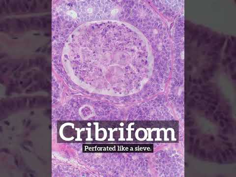 How Does Cribriform Look? | How to Say Cribriform in English? | What is Cribriform?