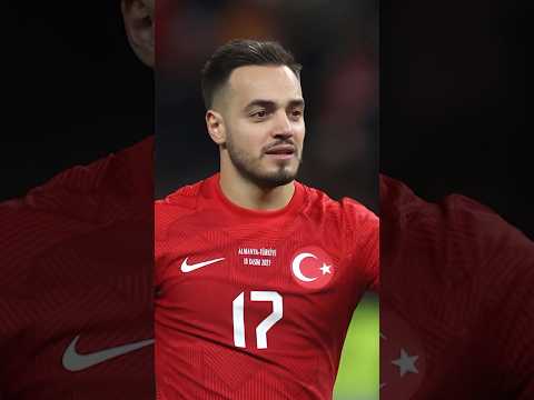 Turkish Professional Soccer Player Yusuf Sari Hair Transplant #yusufsari #hairtransplant #shorts