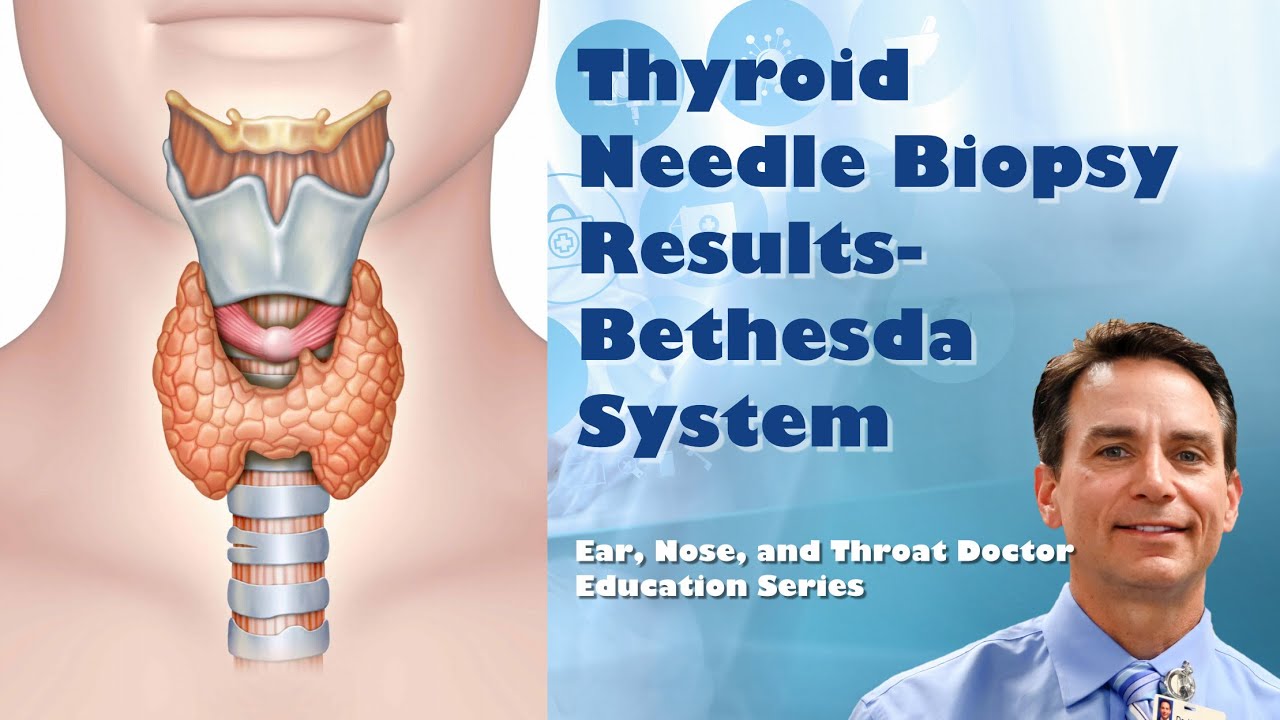 Thyroid Needle Biopsy Results - Bethesda Classification System