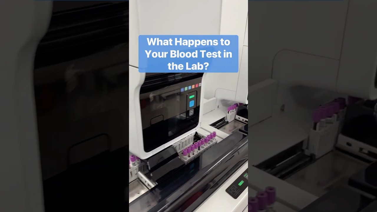 What happens to your blood test in the lab.