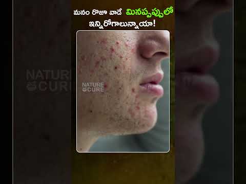 మనం రొజూ వాడే మినప్పప్పులో ఇన్ని రోగాలున్నాయా! | Many diseases in the black gram that we use daily?
