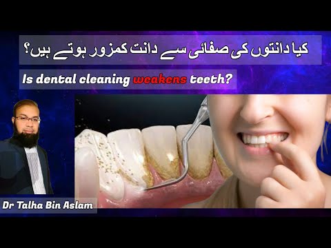 Teeth cleaning/ Teeth scaling. Good or bad? By Dr Talha Bin Aslam