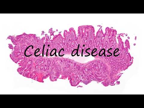 How to pronounce Celiac disease?