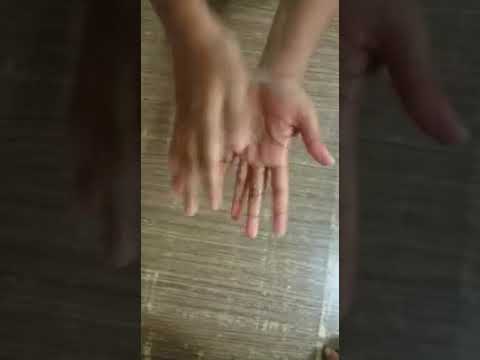 Correct Hand Hygiene Procedure as Demonstrated by the Infection Control Team