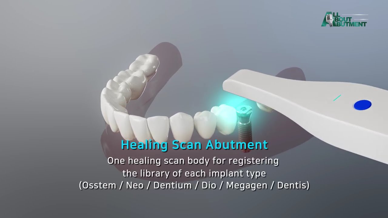 Healing ScanBody