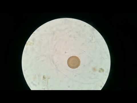Parascaris Equorum Egg