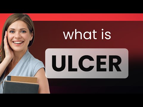 Ulcer — ULCER definition