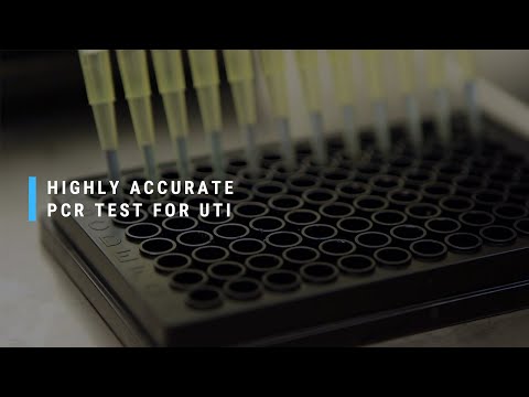 Urinary Tract Infection Detection - FidaLab
