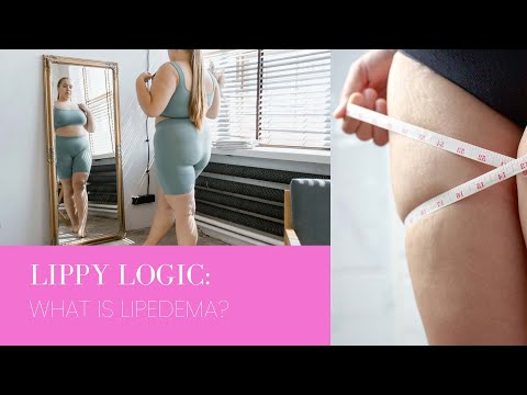 Lippy Logic™ | Episode 3: What is Lipedema? | Dr. David Amron