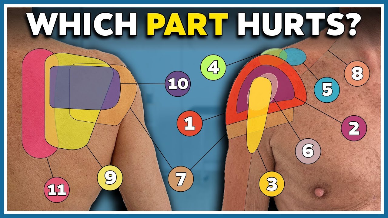 My shoulder hurts here! 12 most common pain locations and what they mean