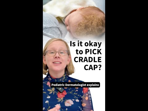 All about cradle cap (seborrheic dermatitis) from a Pediatric Dermatologist