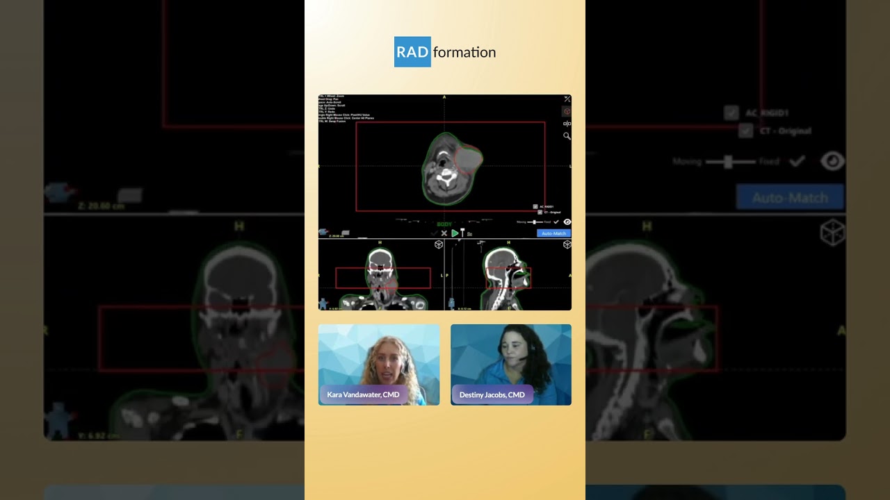 Dosimetry Webinar 2025 - Mastering AutoContour
