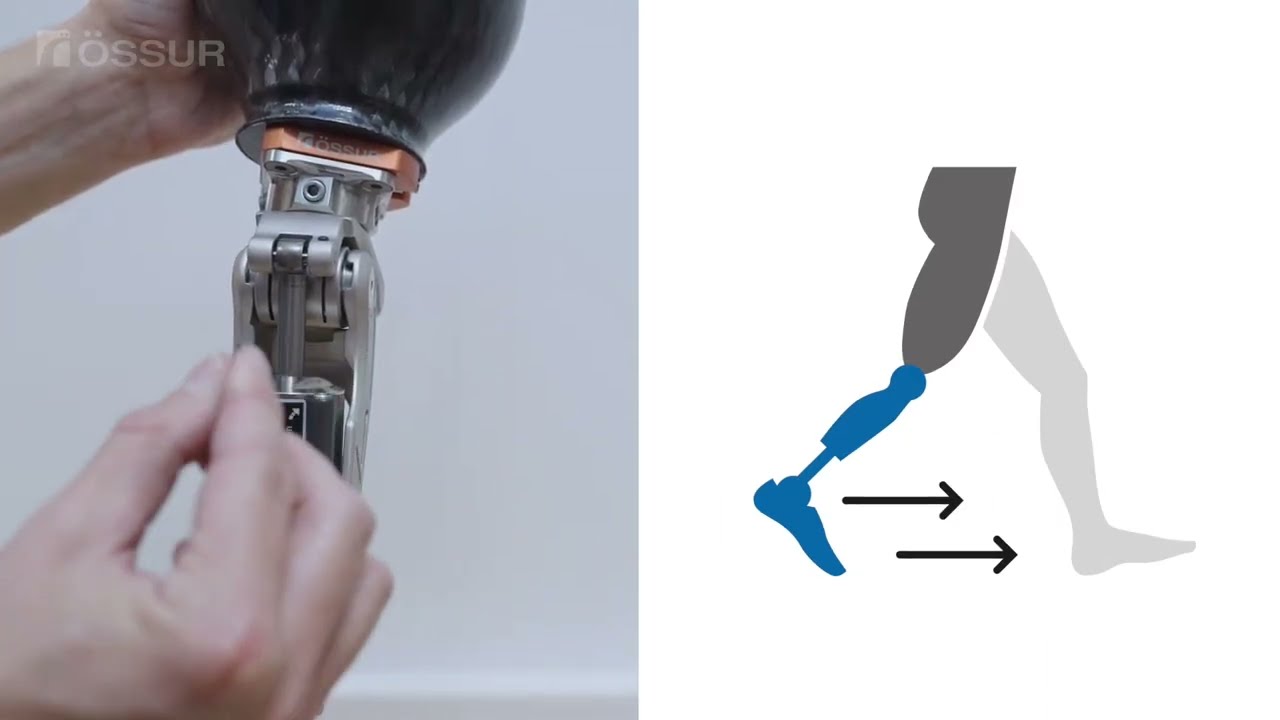 OP4 Knee (Clinician Fitting Tutorial)
