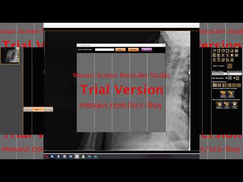 PACS Software - Picture Archiving And Communication System Latest Price ...