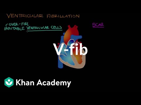 Czym jest migotanie komór (Vfib)? (film) | Khan Academy