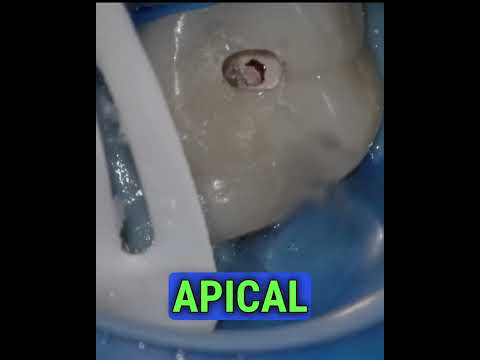 SHAVE YOUR WAY TO THE PULP WITH SHALLOW TOUCH STROKES! 🦷🔬