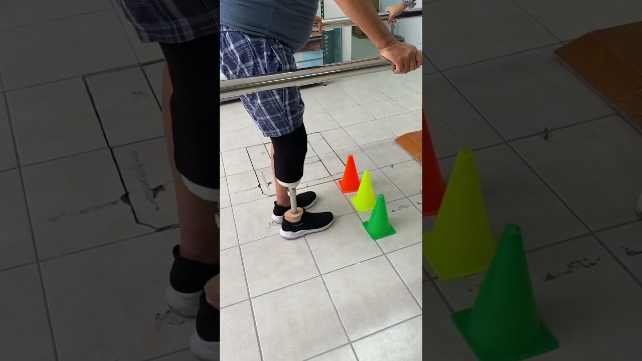 Below knee #amputee rehab #legprosthesis #prosthesis #shots #rehab