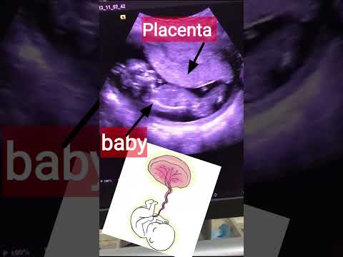 Placenta in pregnancy/ what's Placenta/ shortvideo