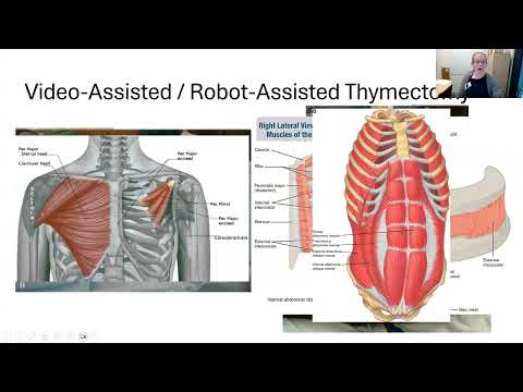 PT & Thymectomy