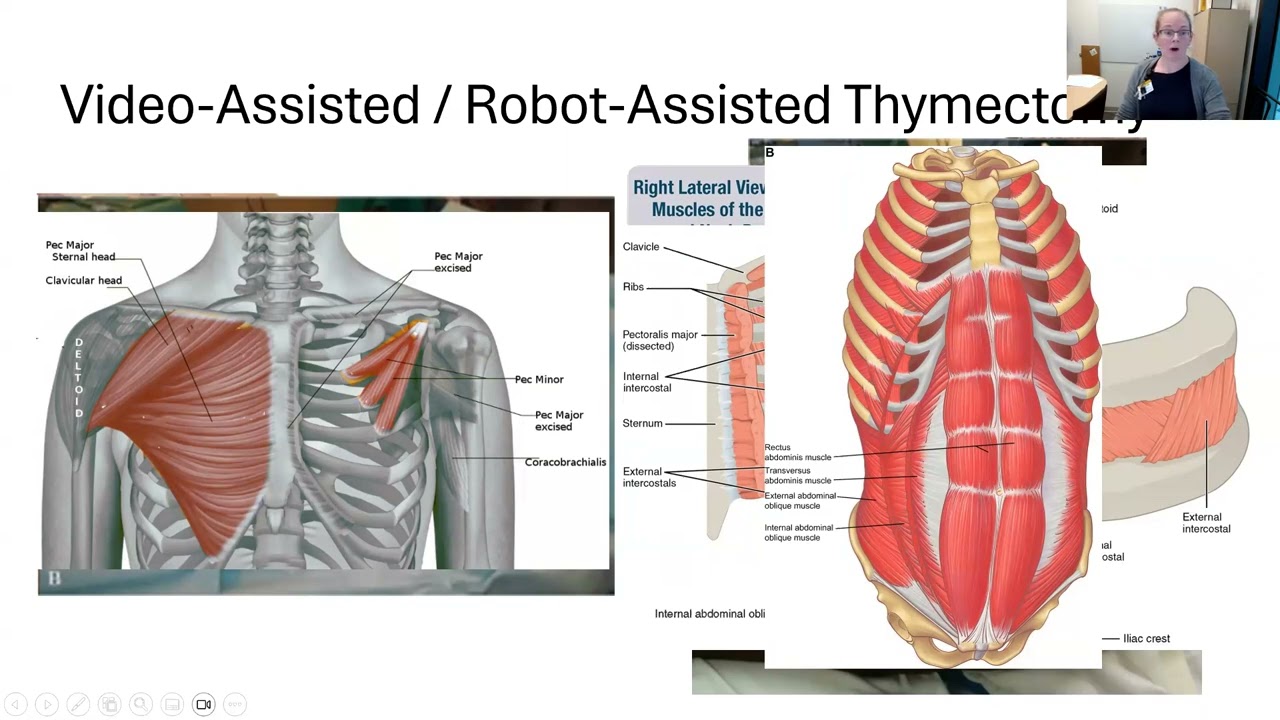 PT & Thymectomy