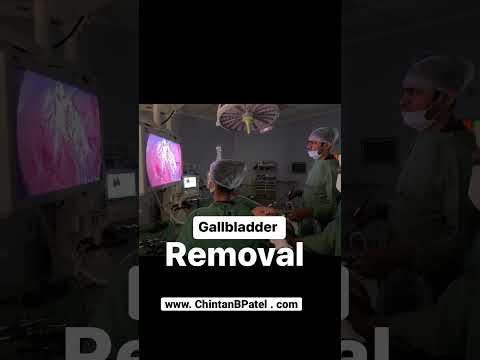 Gallbladder Stone Removal Treatment in India #yoursurgeon