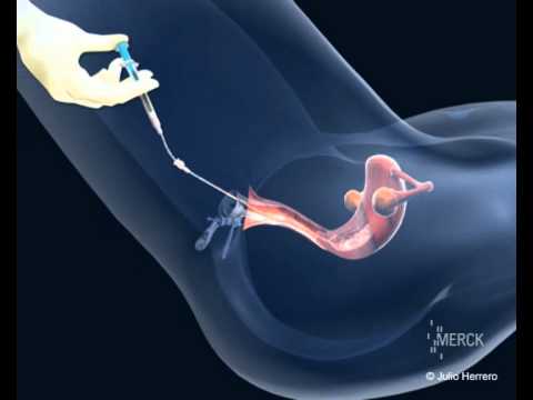 Insemination