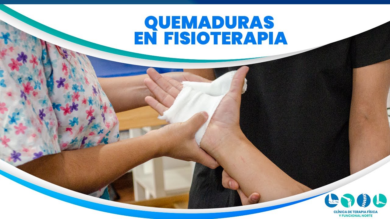 QUEMADURAS EN FISIOTERAPIA | CLÍNICA DE TERAPIA FÍSICA