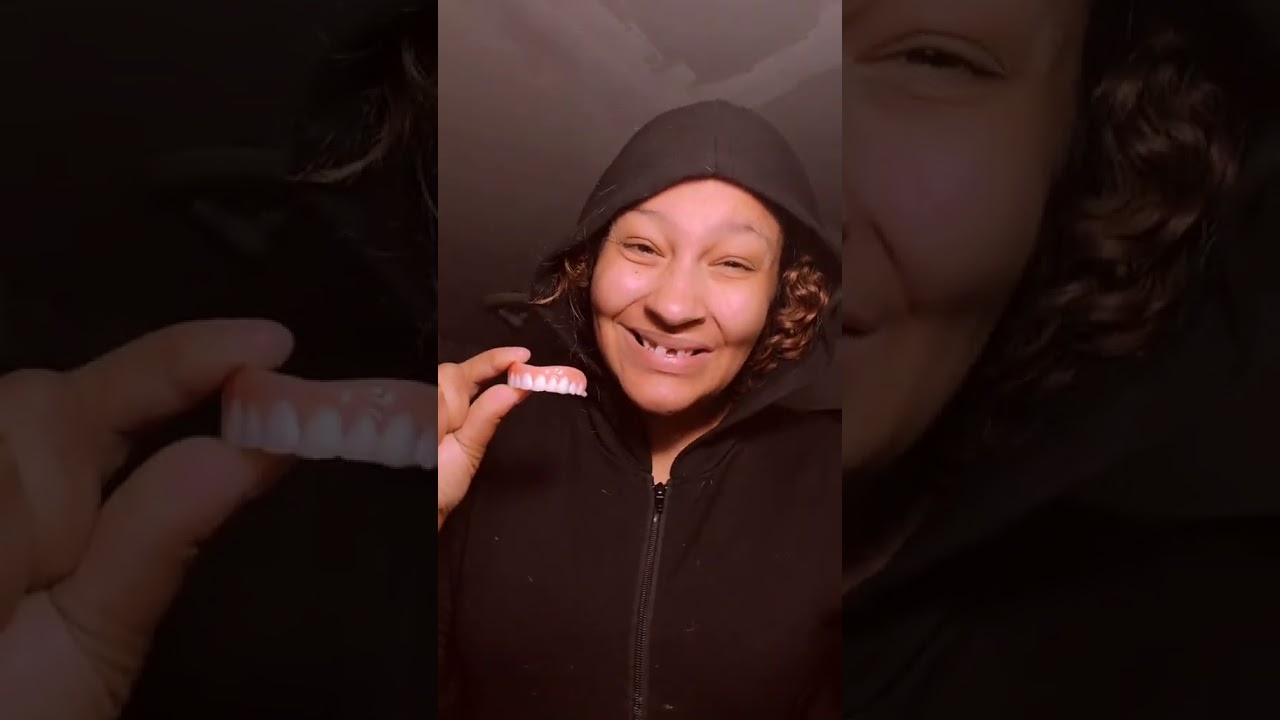 🔥 POWER!!! 😎 What A Transformation 😎 Instant Smile Teeth Veneers 2026