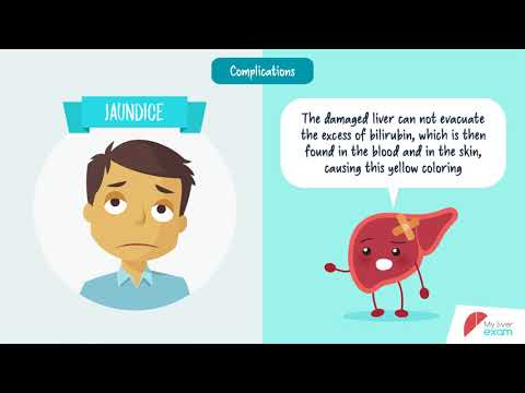 What is liver cirrhosis?