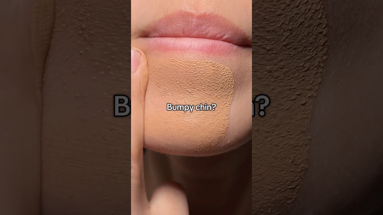 Skincare ingredients for your skin problems #acne #breakouts #bumpyskin #skintexture